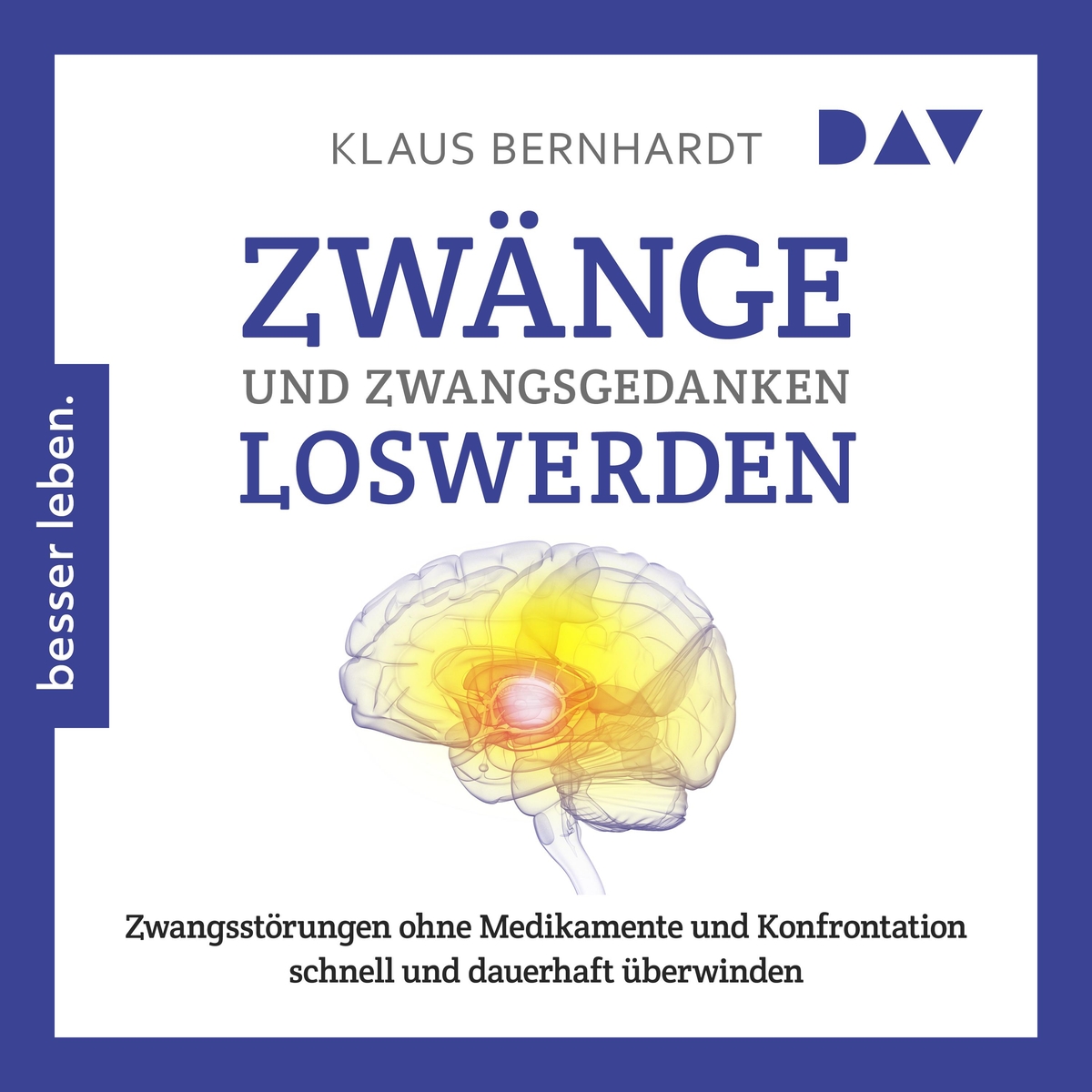 Zwänge und Zwangsgedanken loswerden. Zwangsstörungen ohne Medikamente und Konfrontation schnell ...