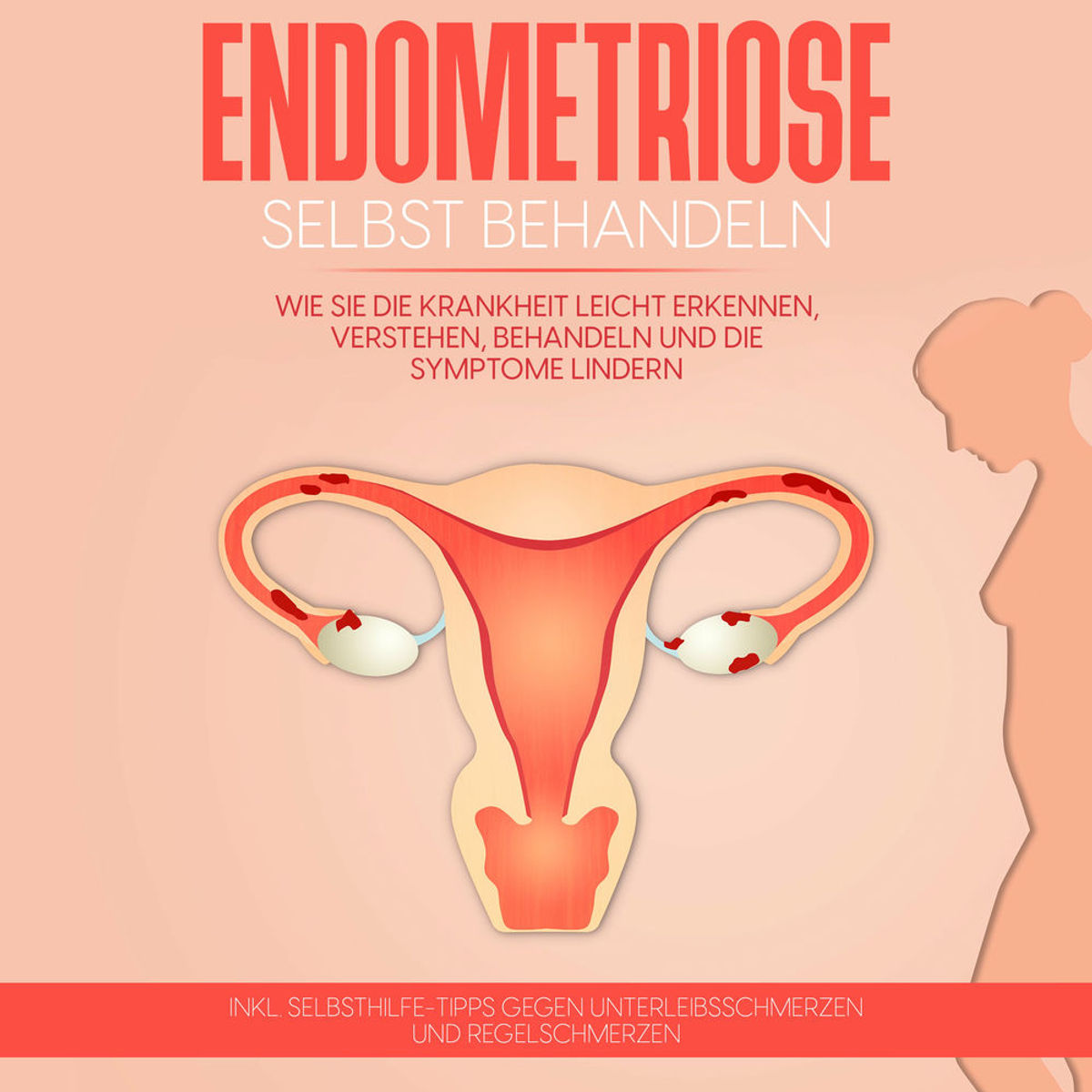 Endometriose selbst behandeln: Wie Sie die Krankheit leicht erkennen, verstehen, behandeln und ...