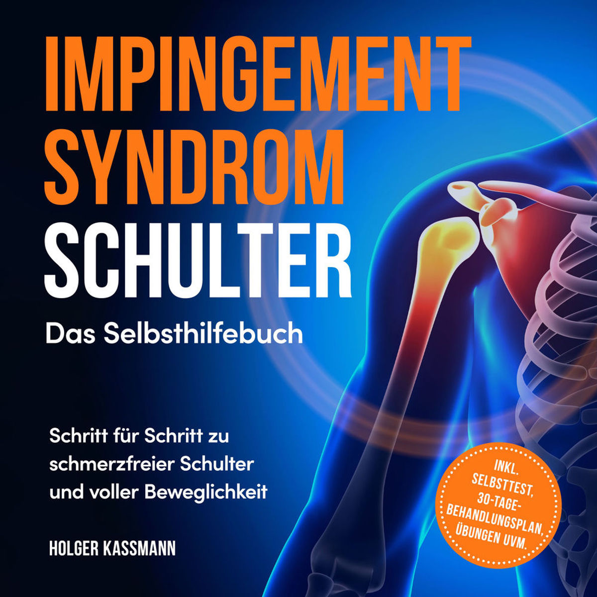 Impingement Syndrom Schulter - Das Selbsthilfebuch: Schritt für Schritt ...