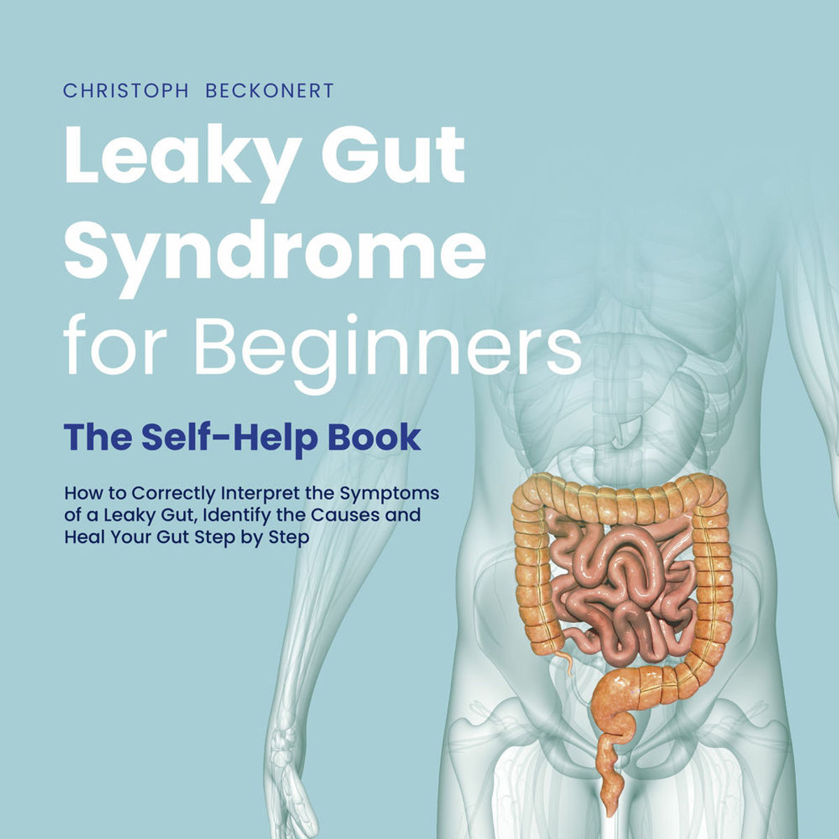 Leaky Gut Syndrome for Beginners - The Self-Help Book - How to ...