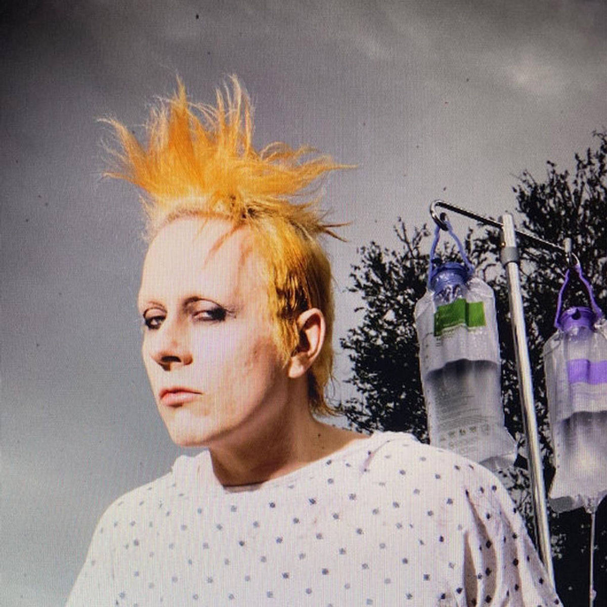 SKOLD Songs streamen | RTL+